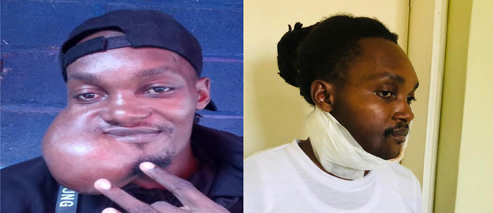 Mesaj Doktè Berly Généus sou zafè operasyon Pierre John Muller. – Triboland